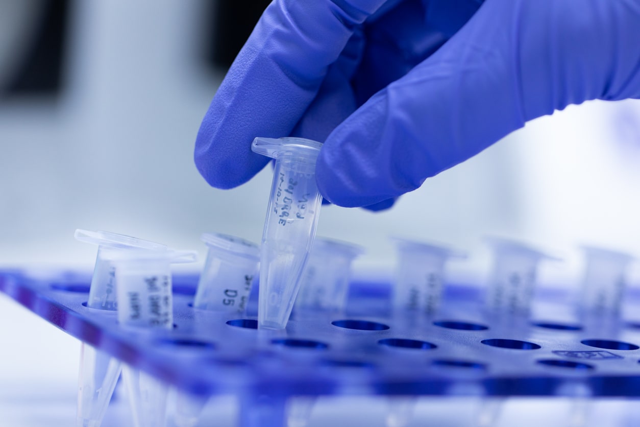 ¿Para qué sirve una prueba de proteína c reactiva (PCR)? - Laboratorio ...